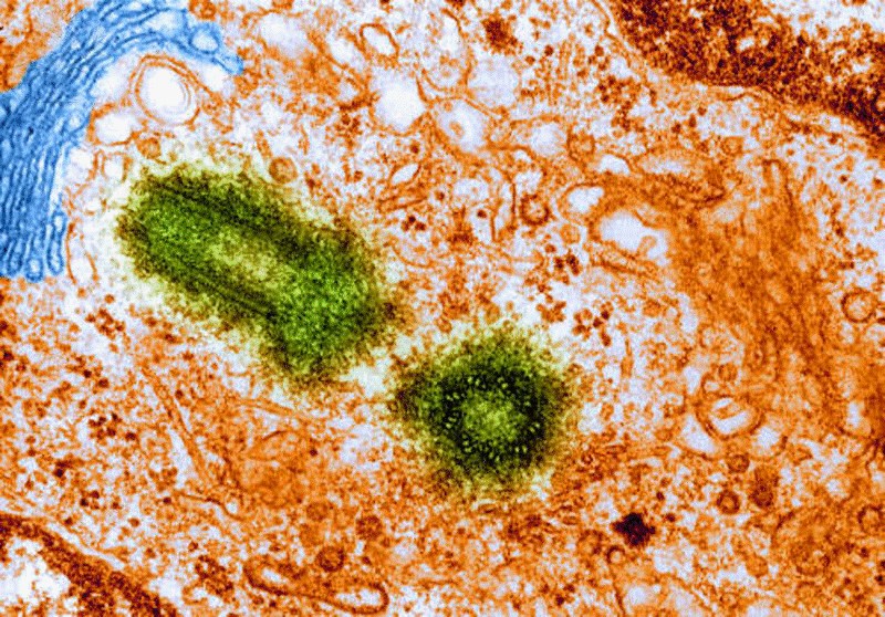 Organelas citoplasmáticas (Citologia) - Resumo de Biologia para o Enem