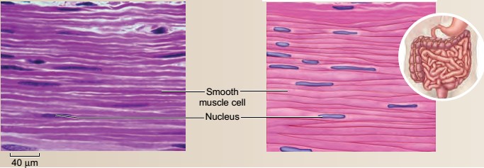Tecido muscular: o que é, tipos e funções